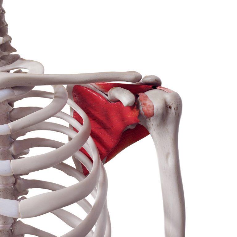 Understanding and Managing Shoulder Tendon Damage Overview — Access Ortho