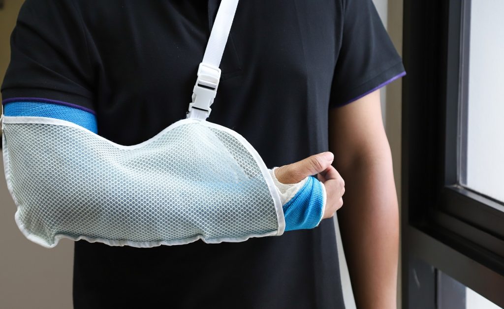 Scaphoid Fracture — Access Ortho