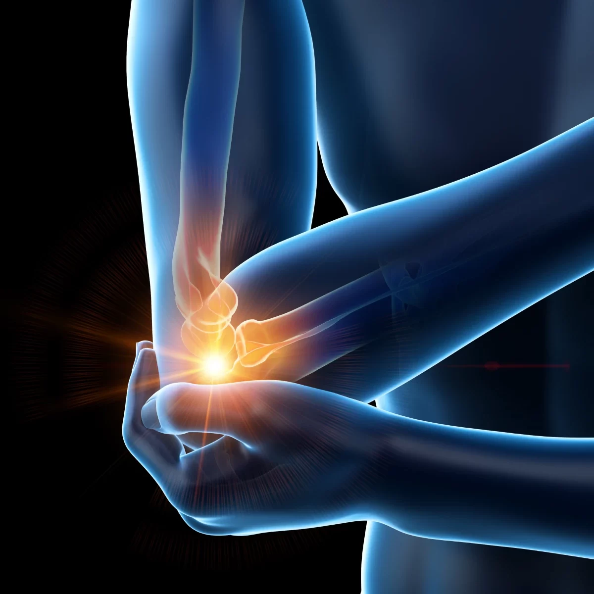 Radial Head Fracture: Understanding, Treatment, and Recovery — Access Ortho