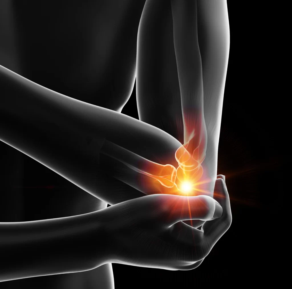 Coronoid Process Fracture: Understanding, Treatment, and Recovery ...