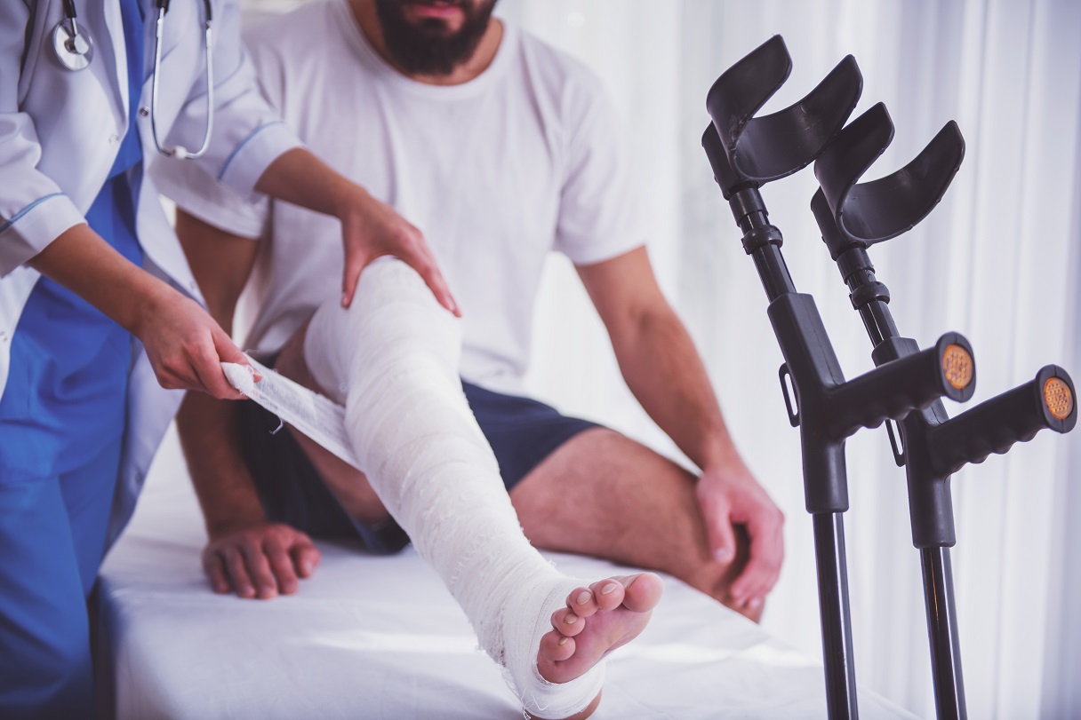 Leg Fractures: Broken/Fractured Leg — Access Ortho