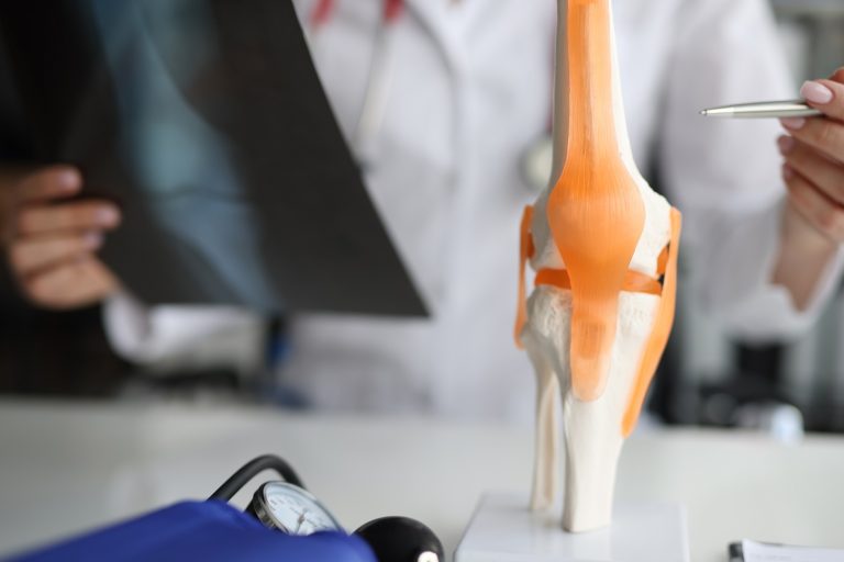 Knee Dislocations — Access Ortho