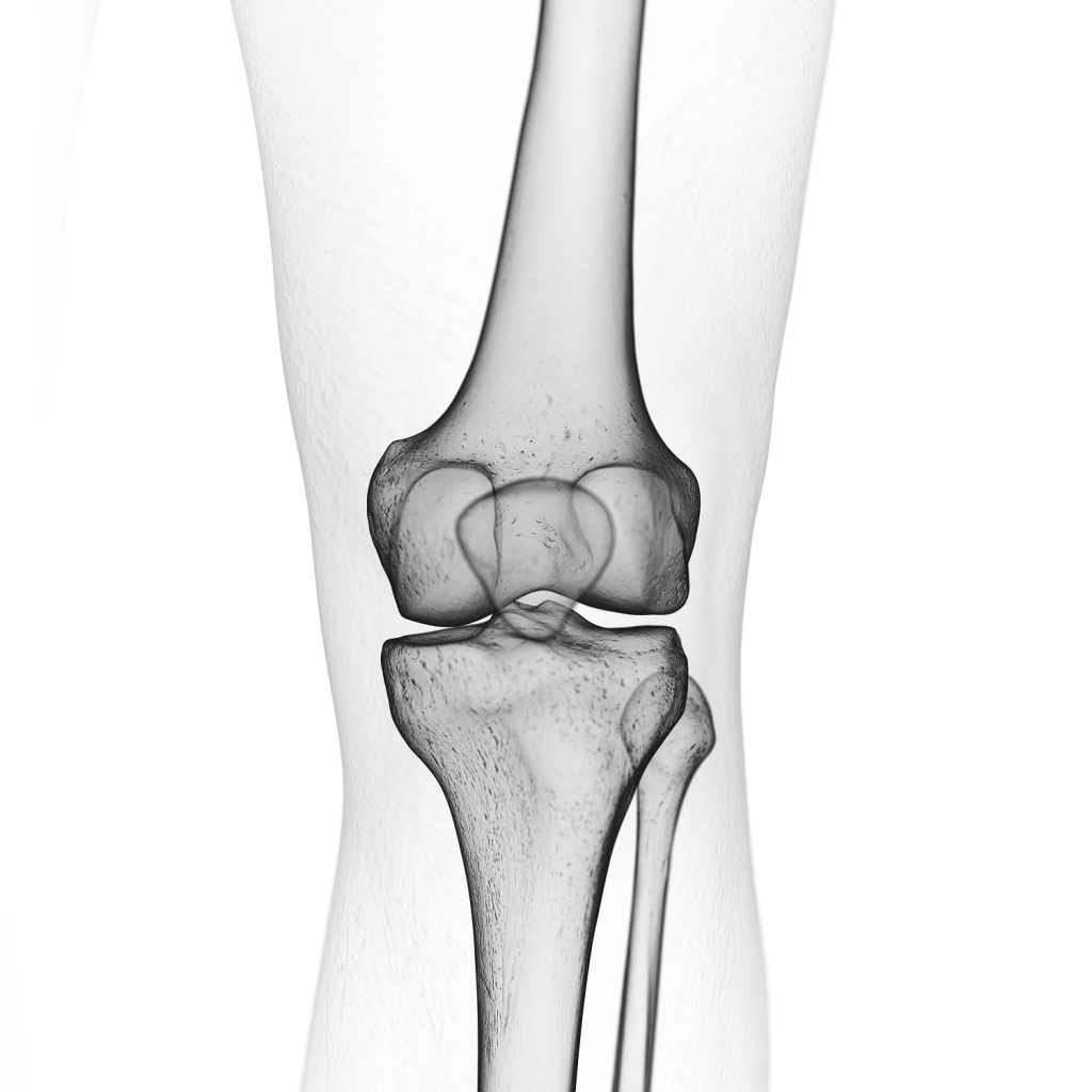 Knee Dislocations — Access Ortho