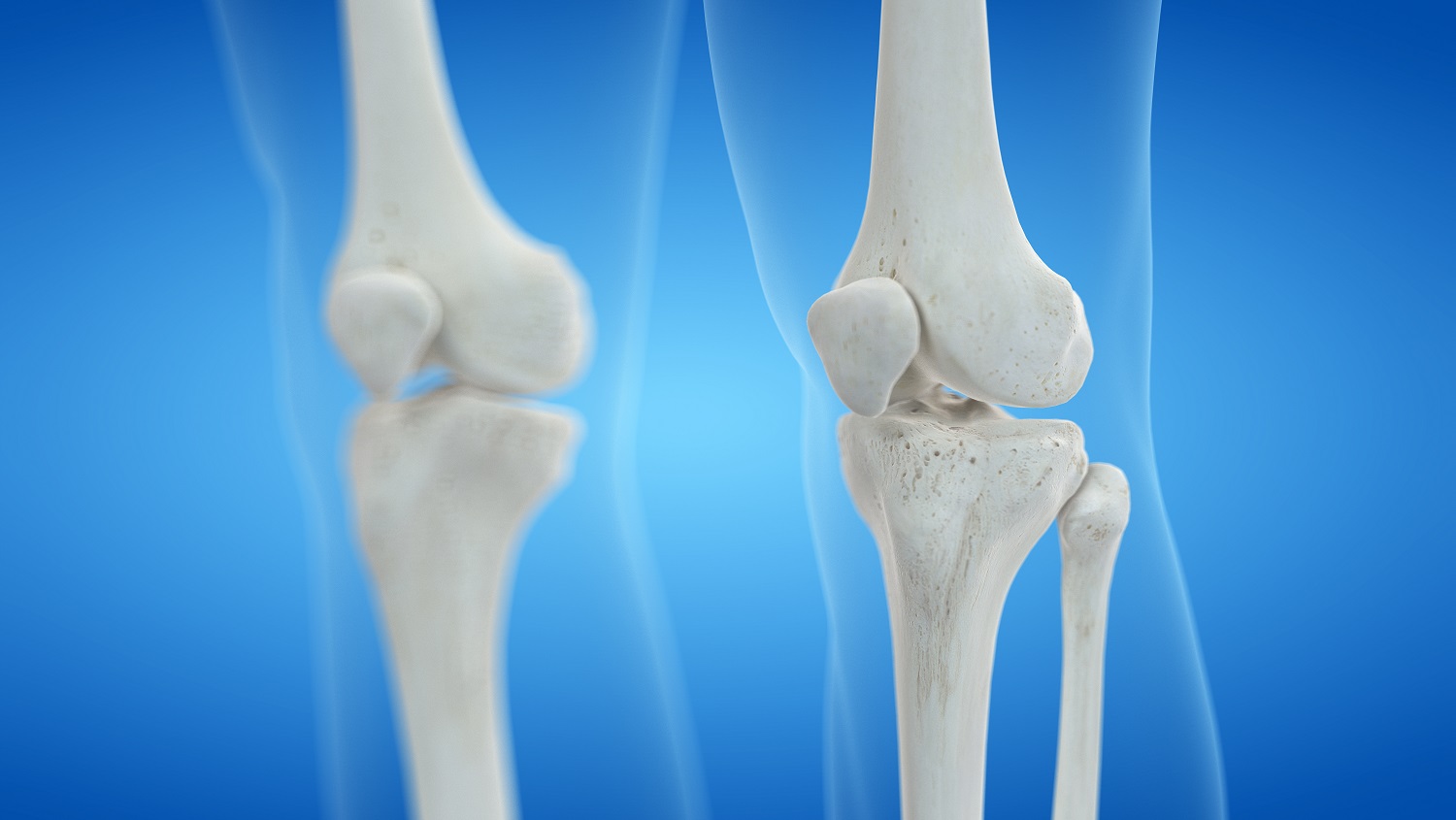 Patella/Knee Cap Dislocation — Access Ortho