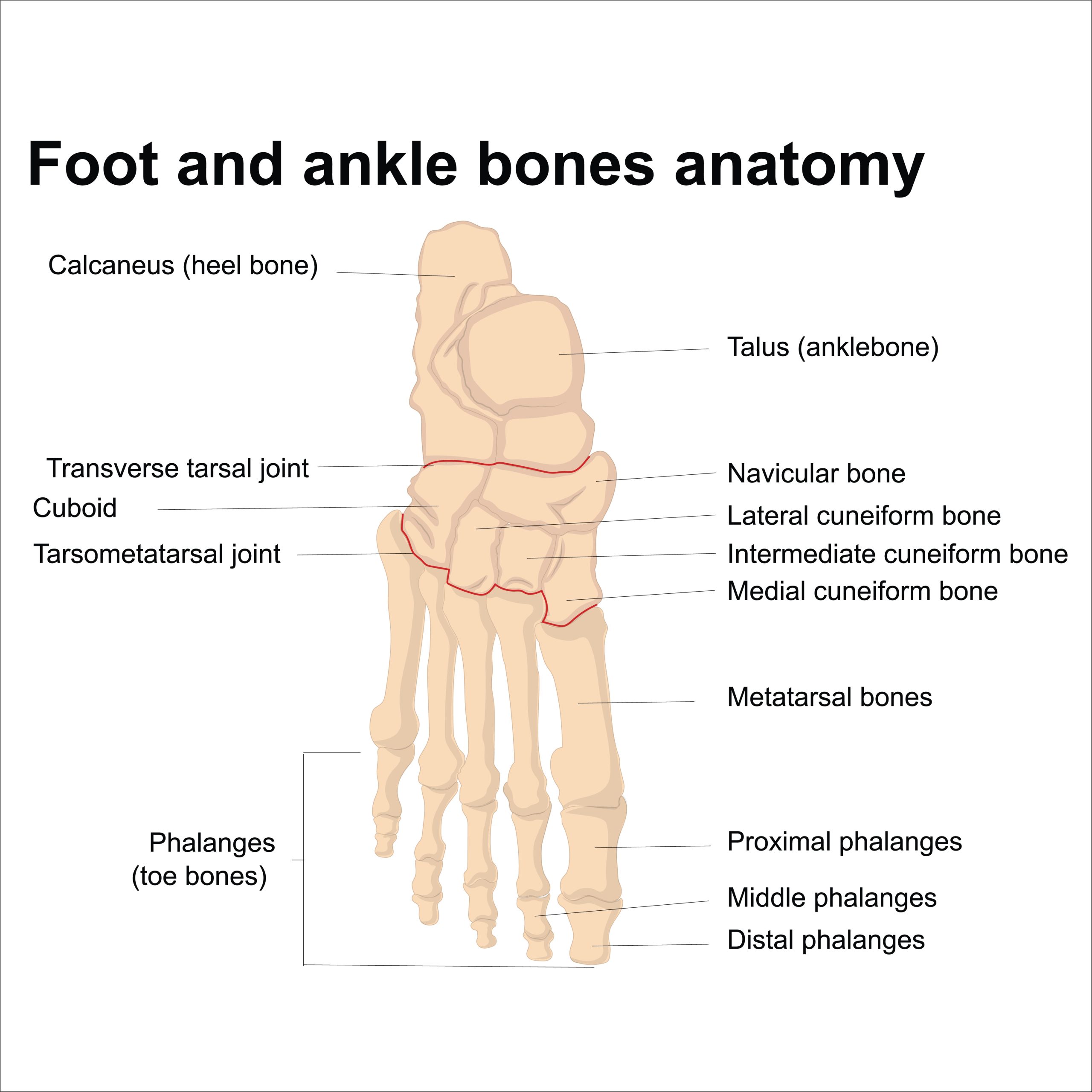 Tarsal Fracture — Access Ortho