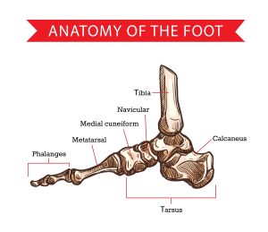 Cuneiform Fracture — Access Ortho