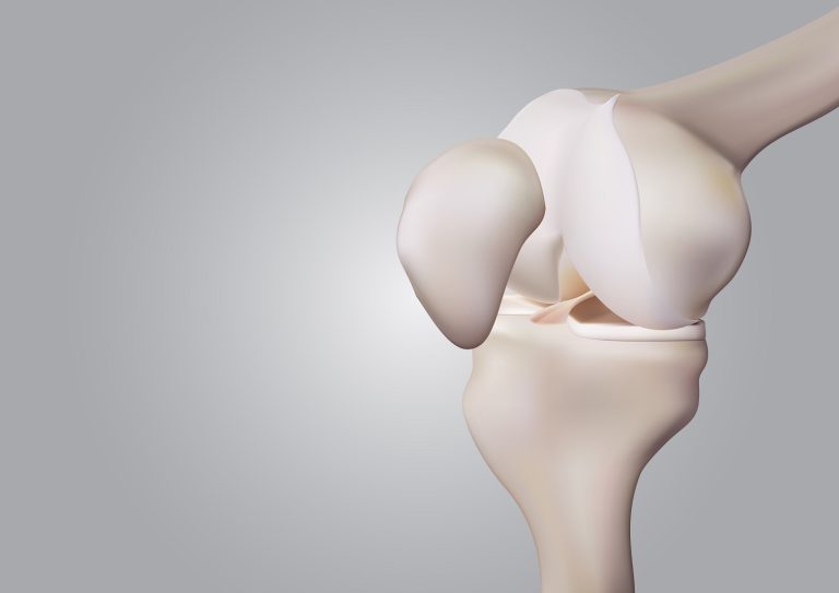 Anterior Cruciate Ligament Acl Tearsprainstrain — Access Ortho 7932