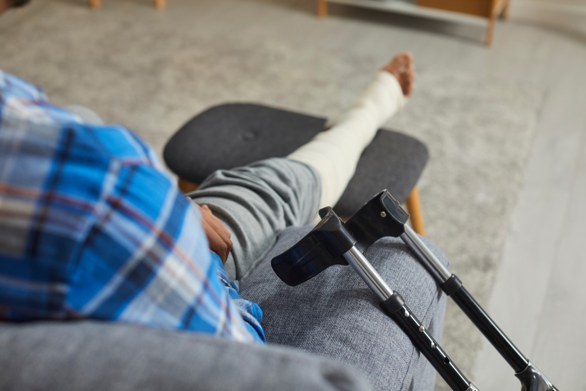 Weber A/B/C Fractures — Access Ortho