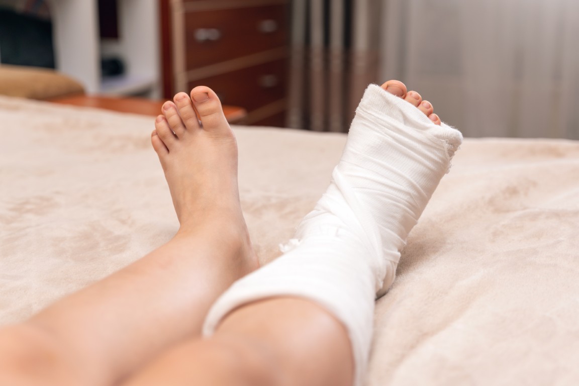 Salter-Harris Fractures of the Ankle — Access Ortho